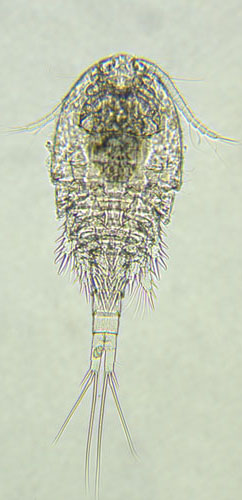 Cyclopoid Detail - Microcyclops varicans (Sars 1863)